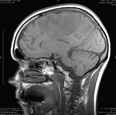 Gadolinio como Medio de Contraste — MS Más Salud