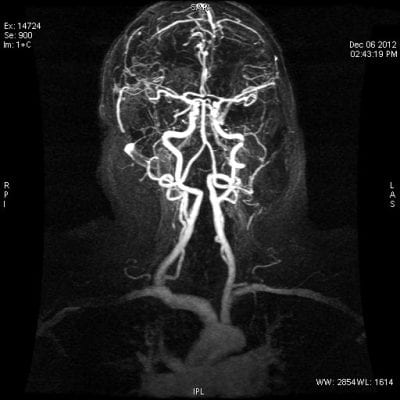 Angioresonancia Cerebral — MS Más Salud