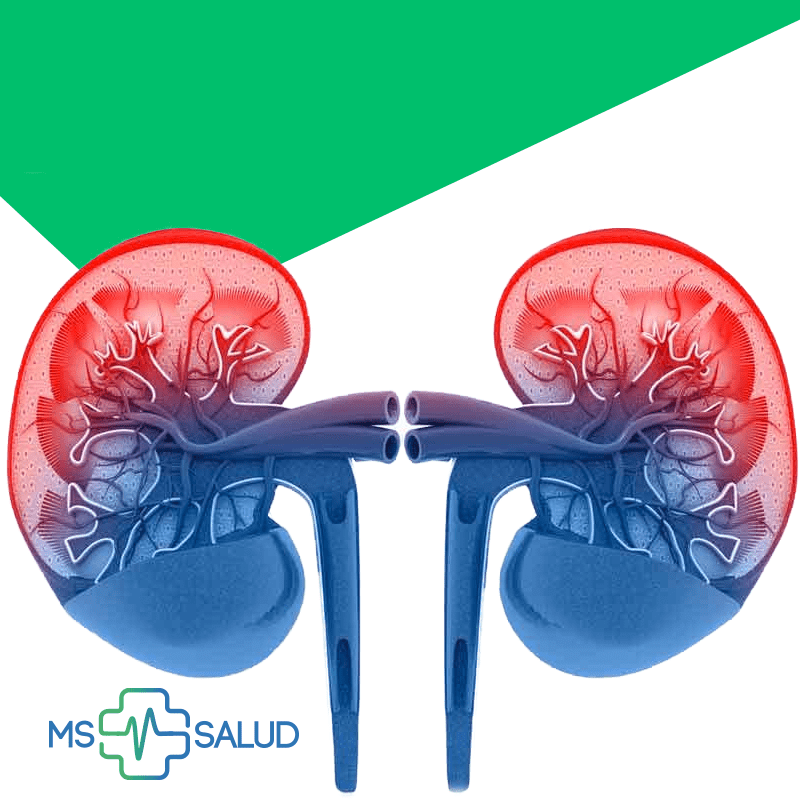Perfil renal | MS Más Salud Laboratorio | Cuidamos más de ti