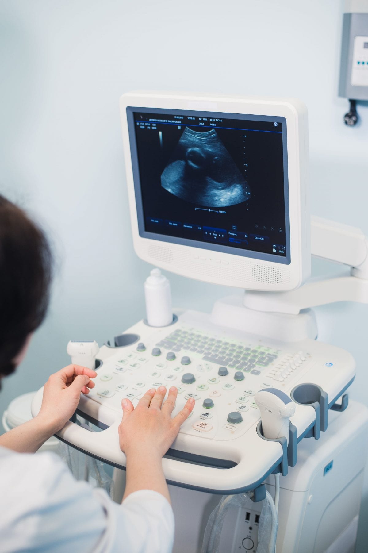 Ultrasonido | MS Más Salud Laboratorio | Cuidamos más de ti